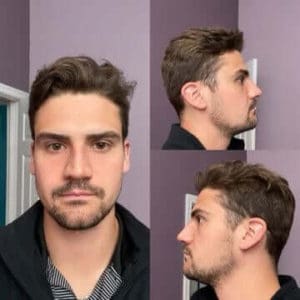 What Is A Scraggly Beard: Tips, Pics, Meaning, Fix, Trim