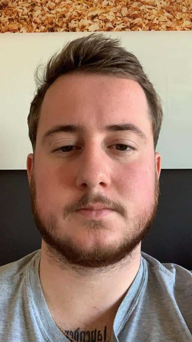 What Is A Scraggly Beard: Tips, Pics, Meaning, Fix, Trim