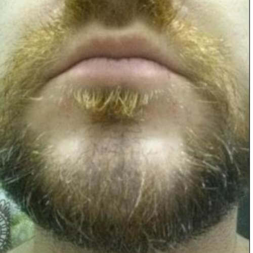 Why Mustaches Grow Straight Out? [5 Fixes To Lay It Down!]