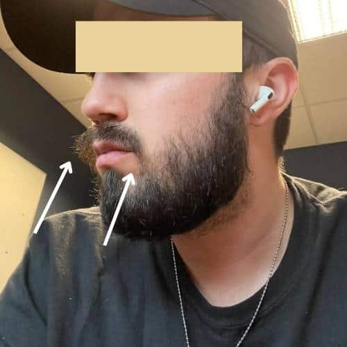 Why Mustaches Grow Straight Out? [5 Fixes To Lay It Down!]